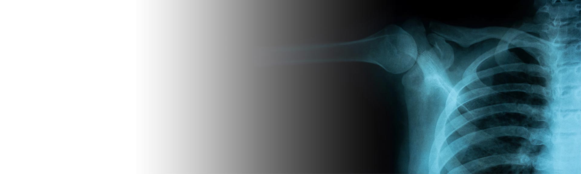 X-ray computed radiography (CR) | Hamamatsu Photonics