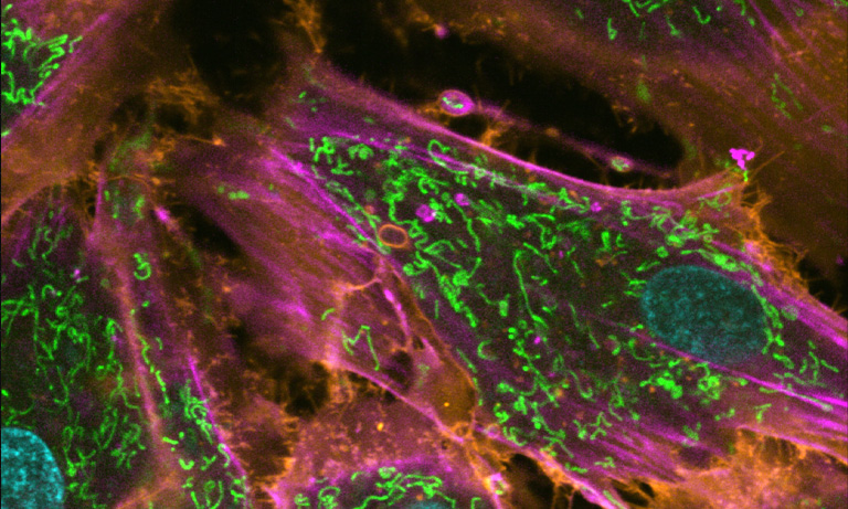 Point-scanning confocal microscopy