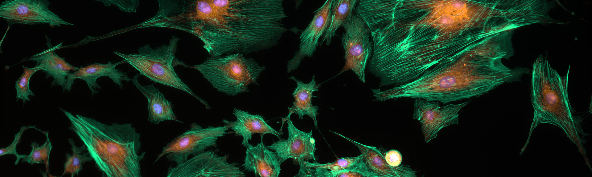 Fluorescence imaging