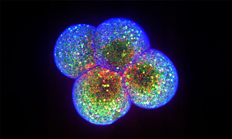 Spinning disk confocal microscopy