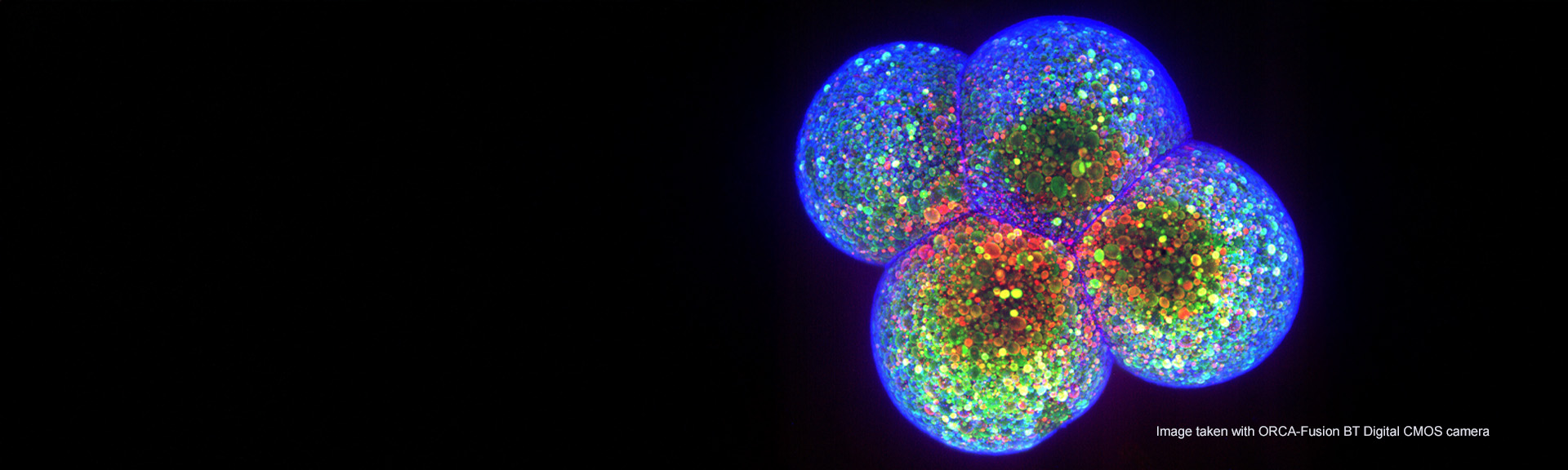 Spinning disk confocal microscopy