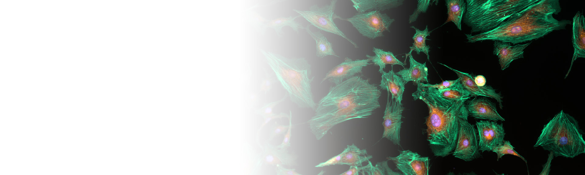 Fluorescence imaging | Hamamatsu Photonics