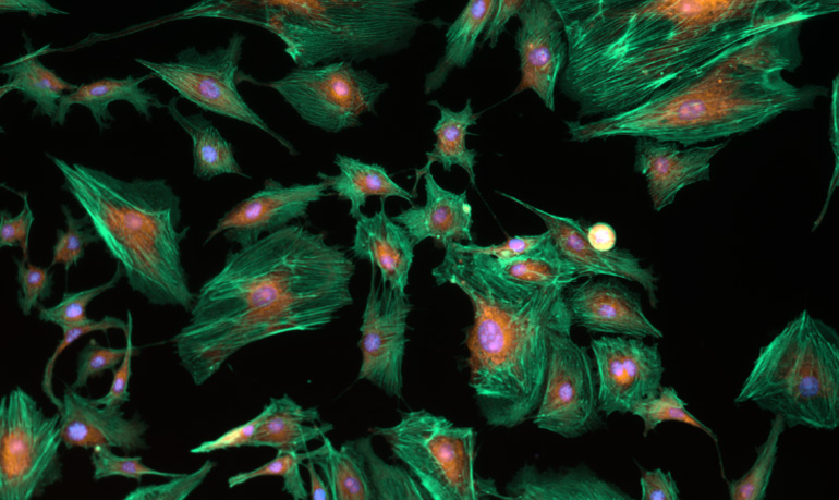 Fluorescence imaging | Hamamatsu Photonics