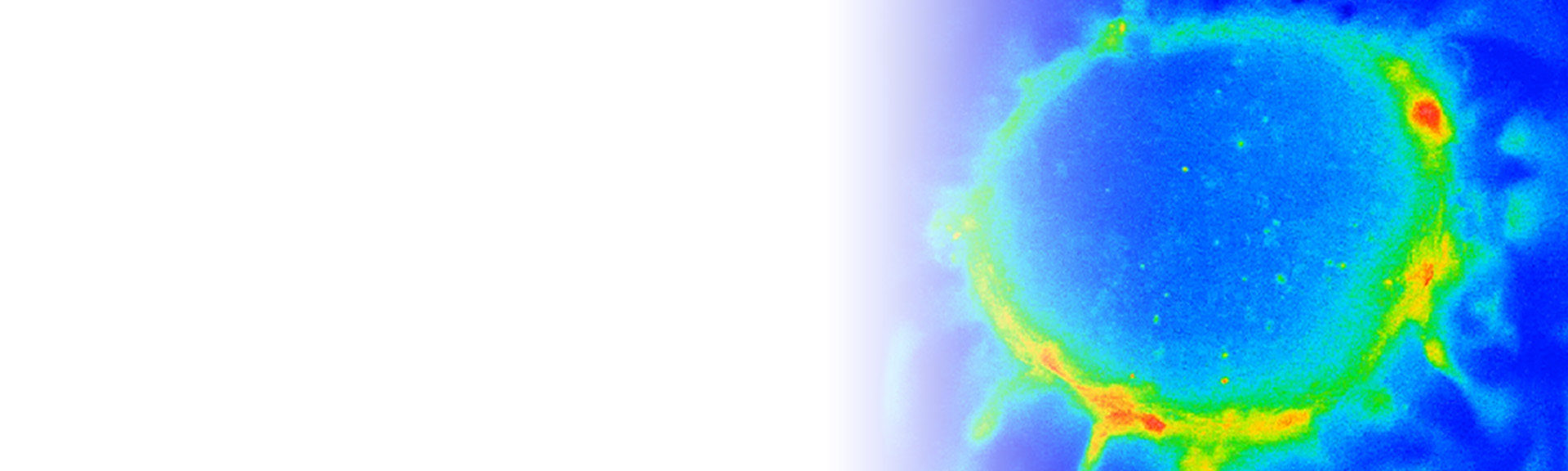 Calcium imaging | Hamamatsu Photonics