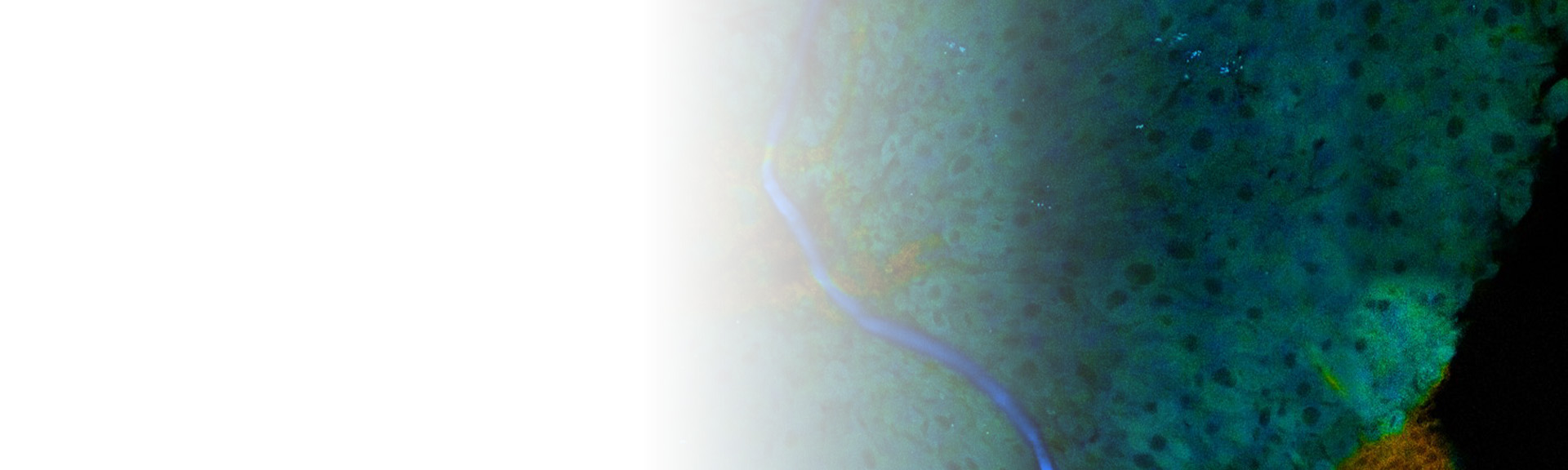 Fluorescence lifetime imaging microscopy | Hamamatsu Photonics