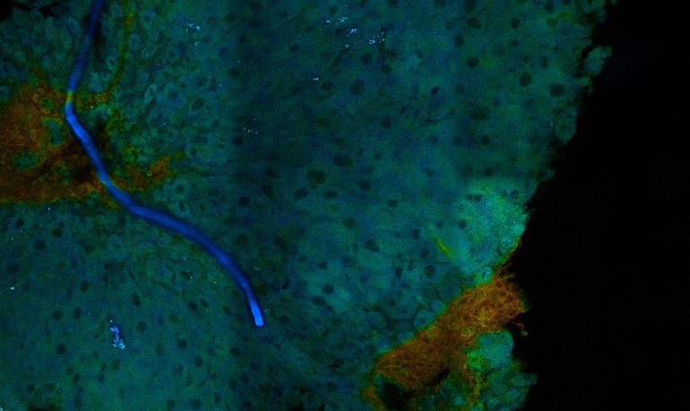 Fluorescence lifetime imaging microscopy | Hamamatsu Photonics