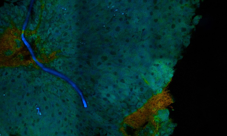 Multiphoton microscopy | Hamamatsu Photonics