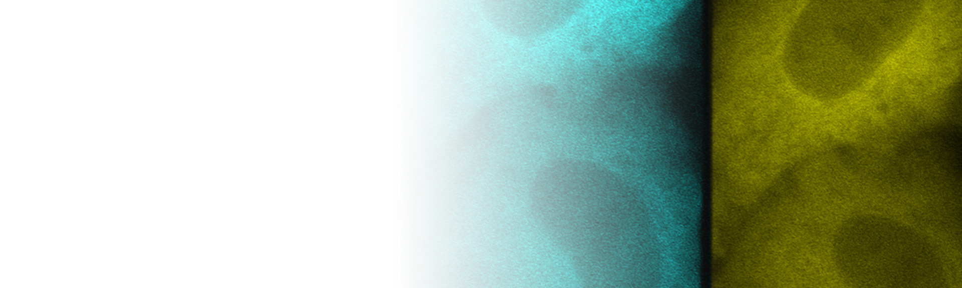 FRET (蛍光共鳴エネルギー移動) | 浜松ホトニクス