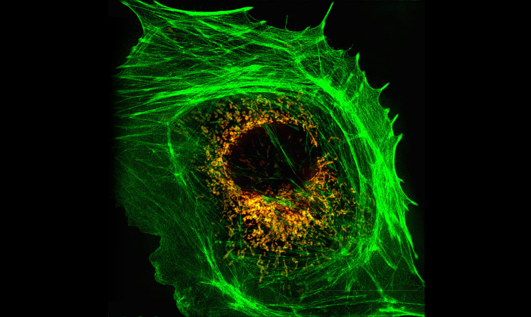 Super-resolution microscopy
