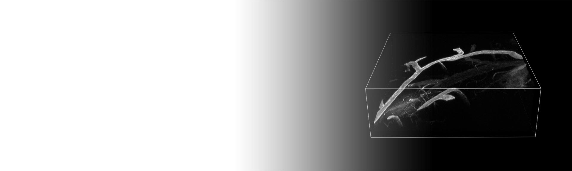 Multiphoton microscopy | Hamamatsu Photonics