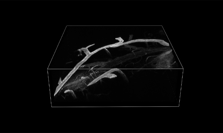 Multiphoton microscopy | Hamamatsu Photonics