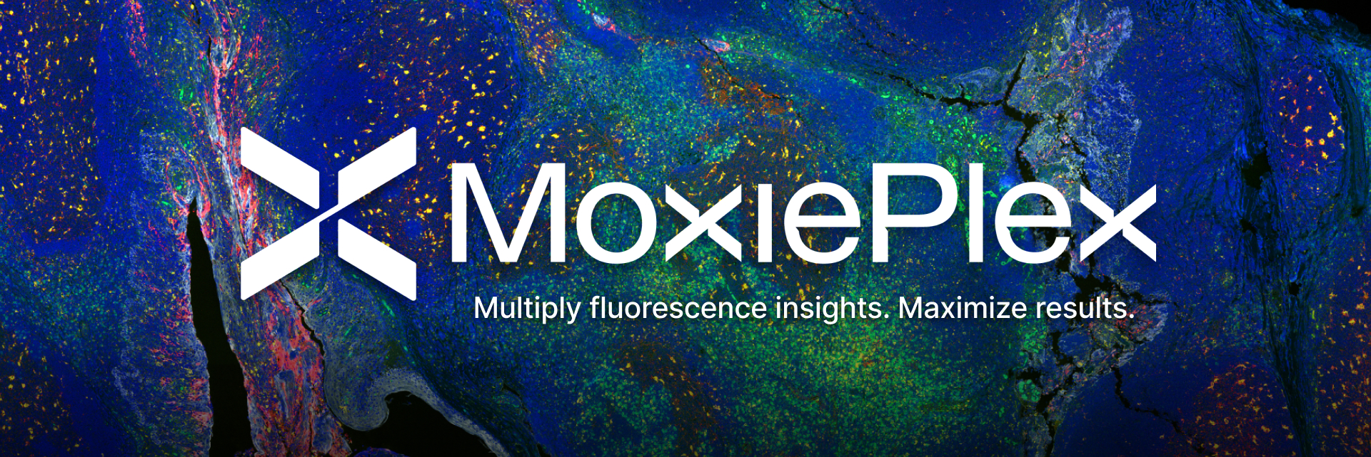 Hamamatsu Photonics has developed a multiplex spatial imaging system ...