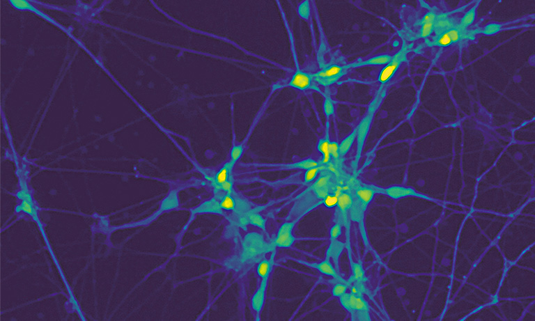 Fluorescence imaging | Hamamatsu Photonics