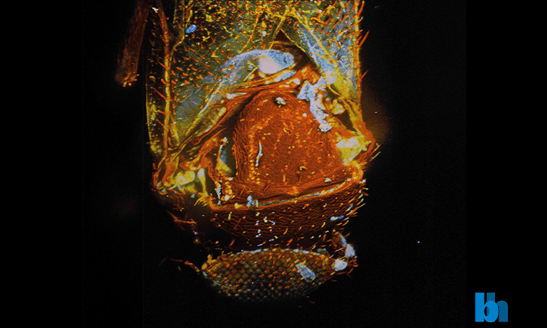 Fluorescence lifetime imaging microscopy | Hamamatsu Photonics