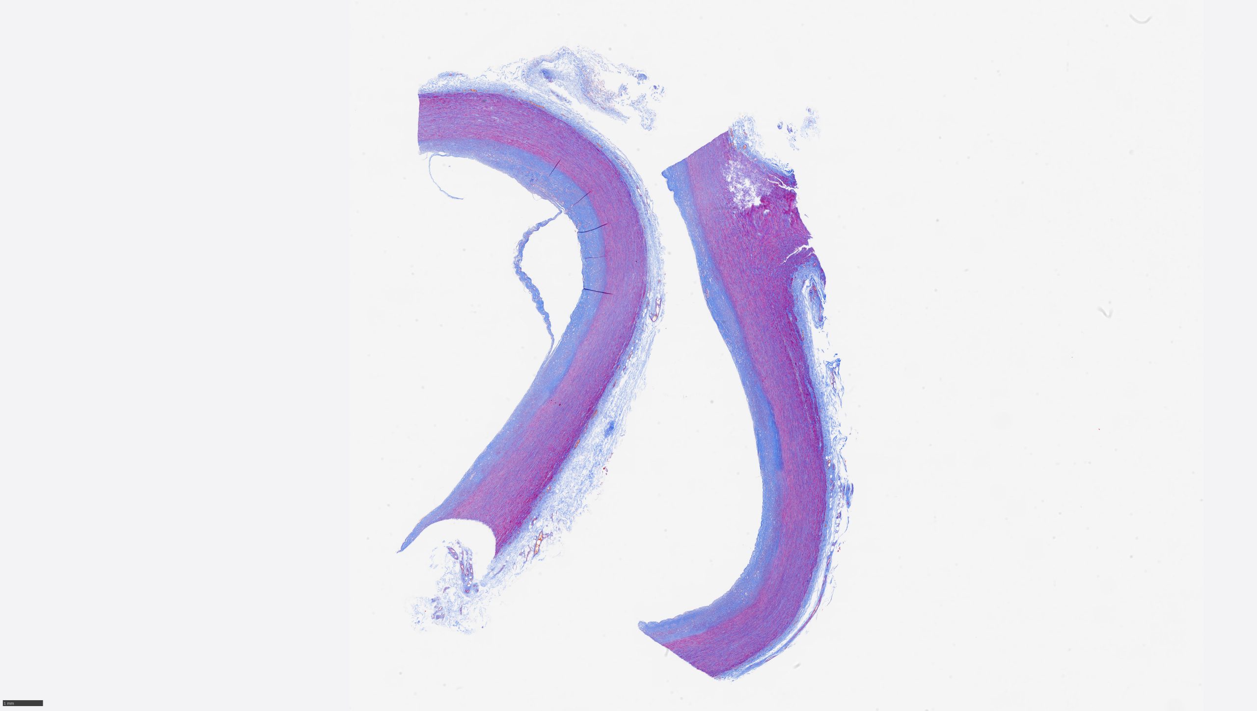 NanoZoomer S360MD Digital slide scanner | Hamamatsu Photonics