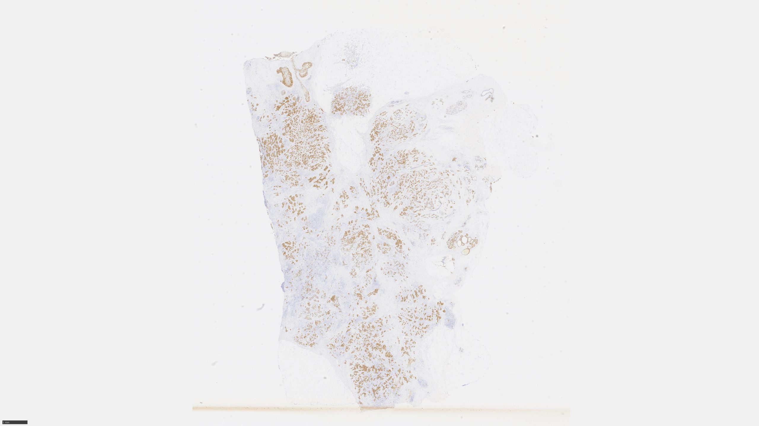 NanoZoomer S360MD Slide scanner system C13220-01MD | Hamamatsu Photonics