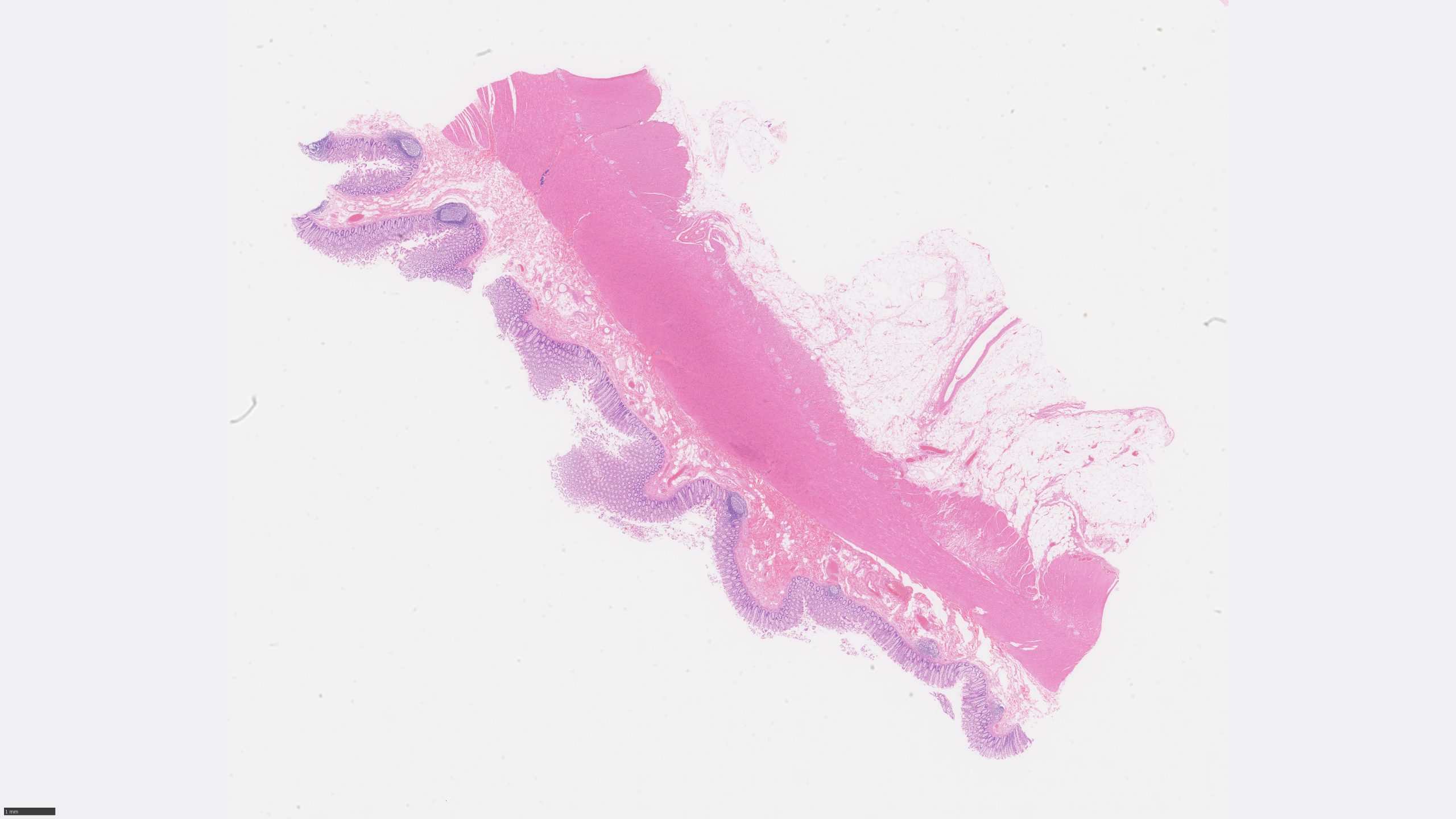 NanoZoomer S360MD Digital slide scanner | Hamamatsu Photonics